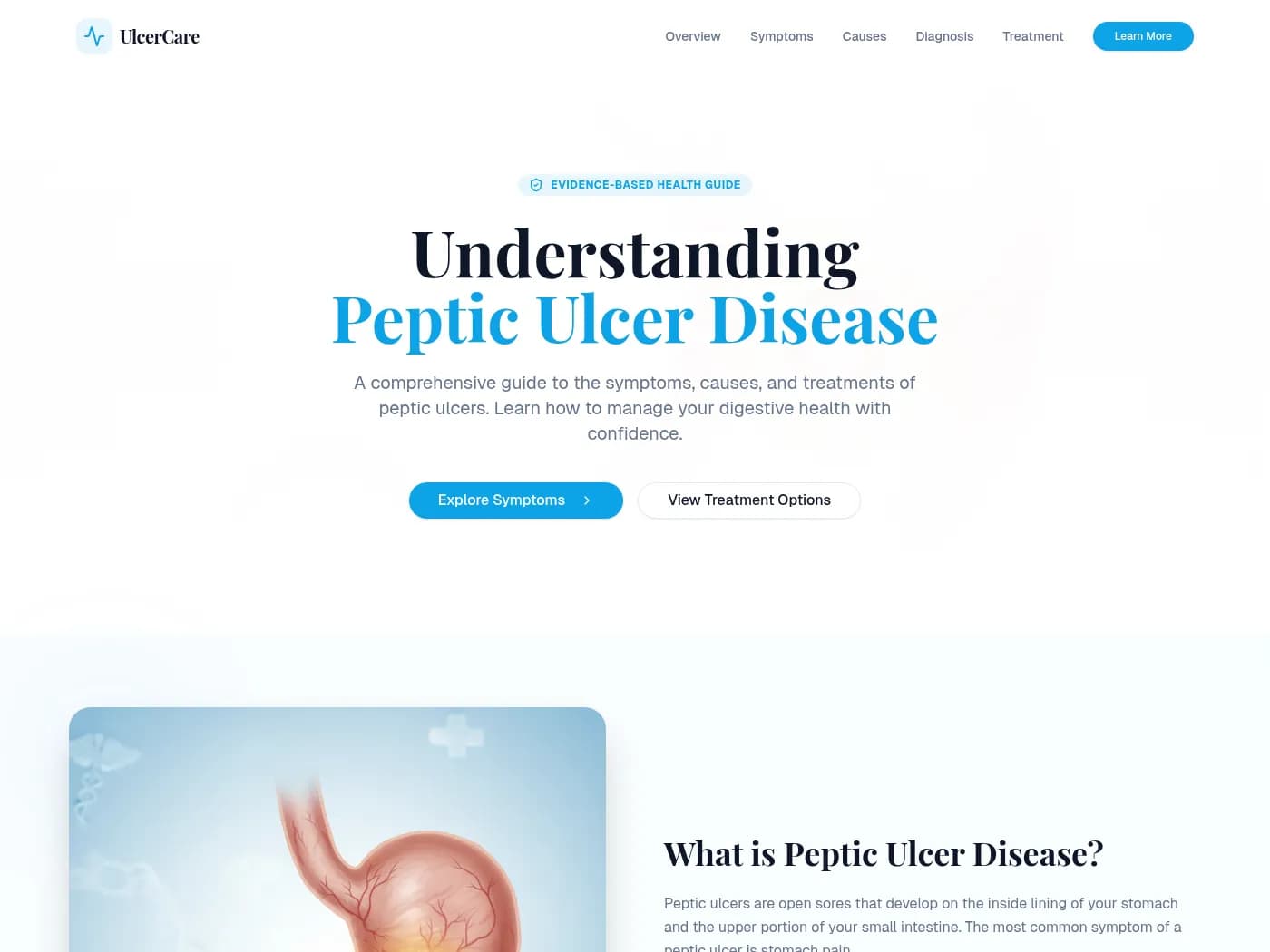 Peptic Ulcer Info Site