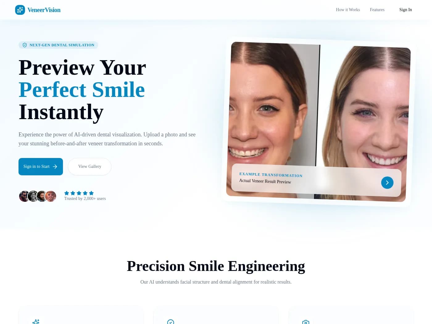 Veneer Vision Simulator