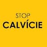 Stop Calvicie