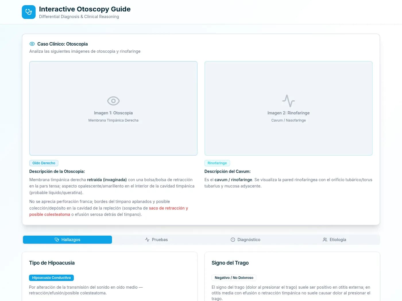 Interactive Otoscopy & Otitis Differential Diagnosis Guide